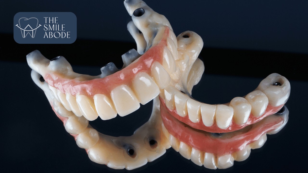 Best Full Mouth Implants in Gurugram for Complete Restoration